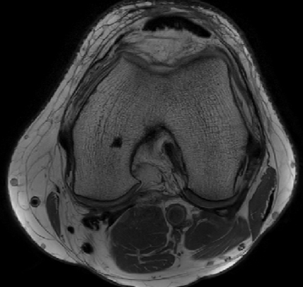 Common MRI Sequences