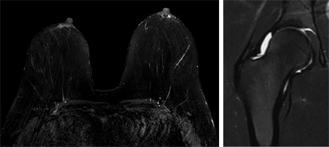 Common MRI Sequences