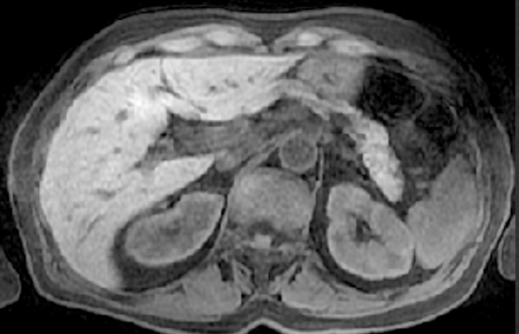 Common MRI Sequences