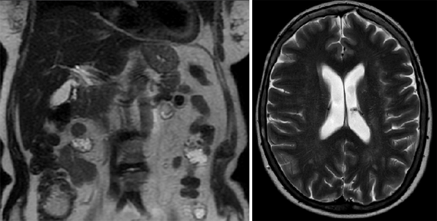 Common MRI Sequences