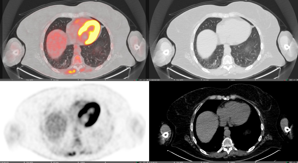 Introduction to PET-CT