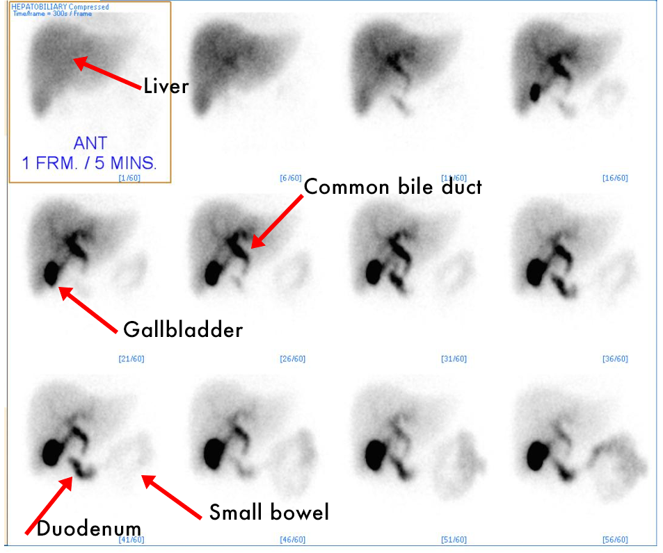 Nuclear Medicine