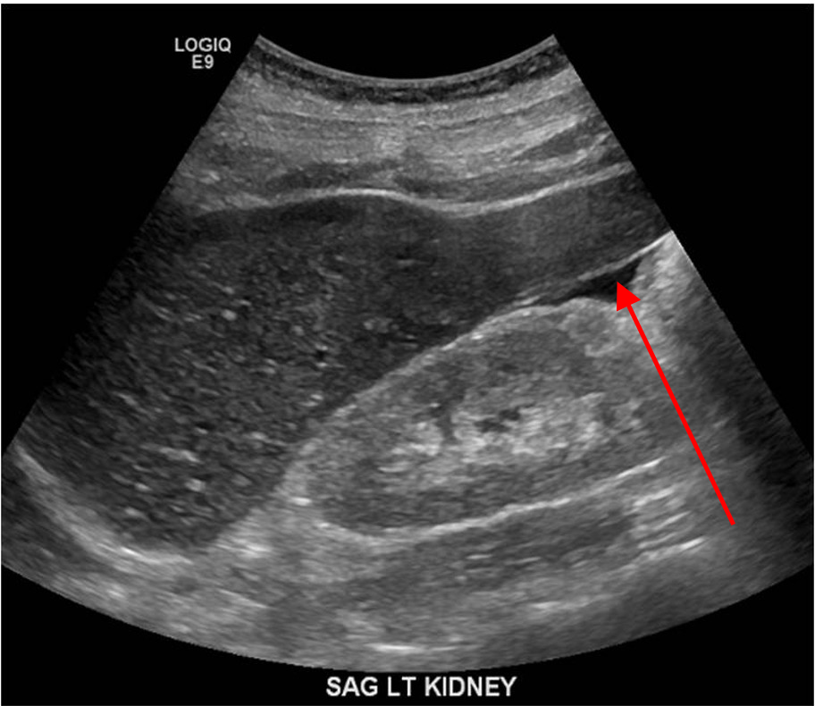 Common Ultrasound Applications